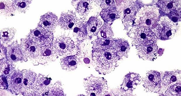 Do immune cells exert free will? | TheHealthSite.com