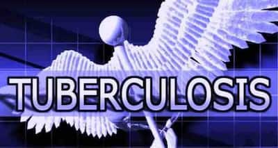 World TB Day: 11 ways to prevent tuberculosis! | TheHealthSite.com