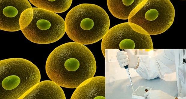 Stem cell therapy - what you ought to know | TheHealthSite.com