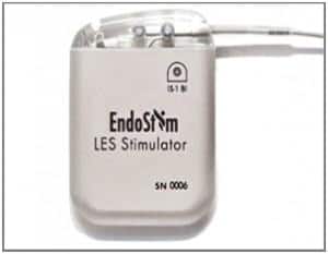 Beat acid reflux, GERD with Endostim - the new minimally invasive ...