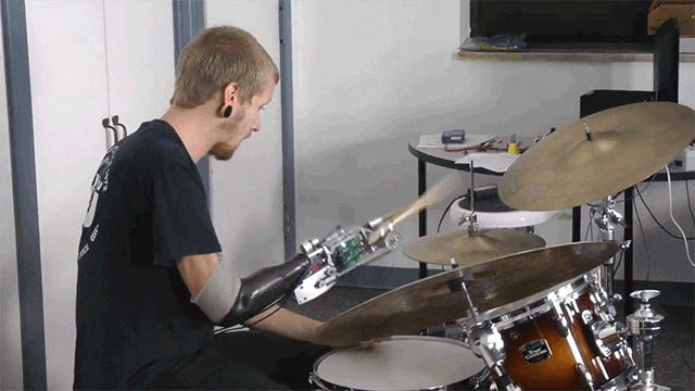 Robotic prosthesis turns amputee drummer into three-armed cyborg ...