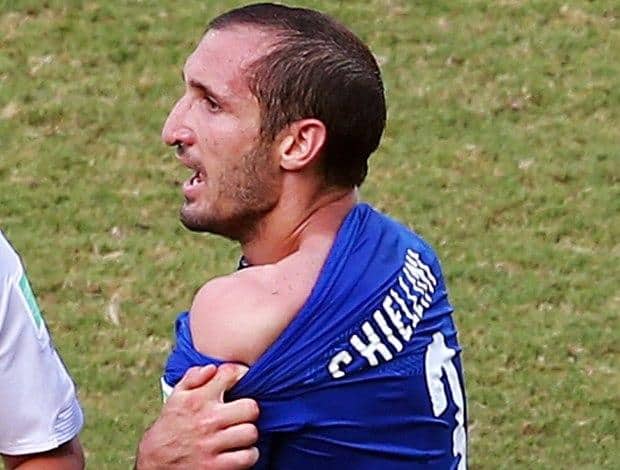Luis Suarez bites Giorgio Chiellini - does the talented footballer need ...