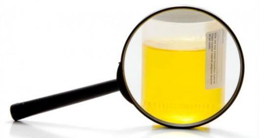 11 causes of dark coloured urine you might not know about ...