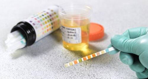 Causes for elevated uric acid levels | TheHealthSite.com