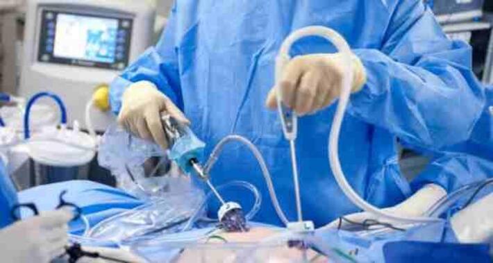 27-year-old undergoes laparoscopic surgery to treat colon cancer ...