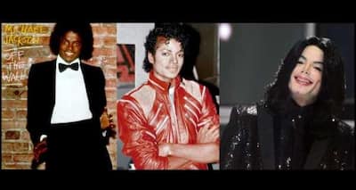 6 cosmetic surgeries that transformed Michael Jackson | TheHealthSite.com