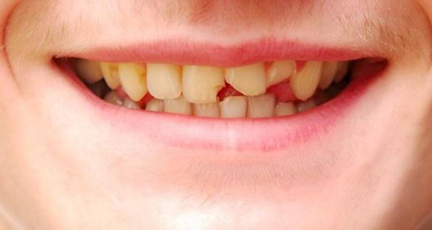 Daily Health Tip: 10 facts about your teeth you have never heard before ...