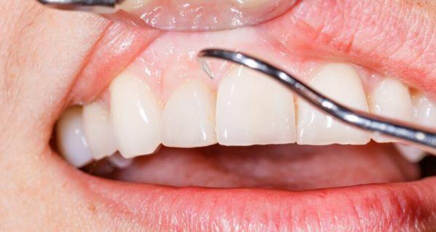 Daily Health Tip: 10 facts about your teeth you have never heard before ...