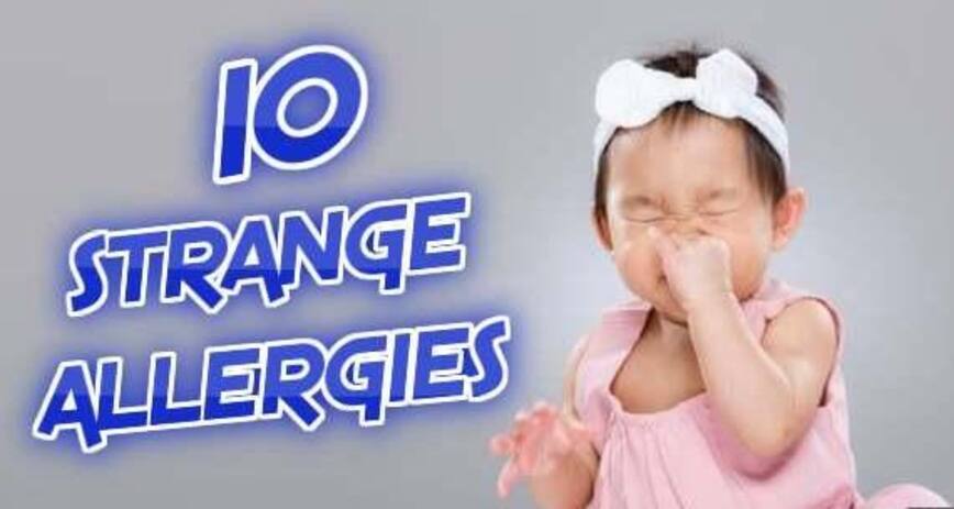 Hives: Here's All You Need To Know About The Infection