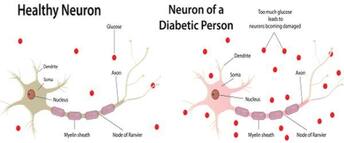Brain Disease: Types, Symptoms, Causes, Treatment, and Brain diseases List