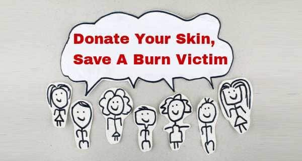 Here's everything you need to know about skin donation | TheHealthSite.com