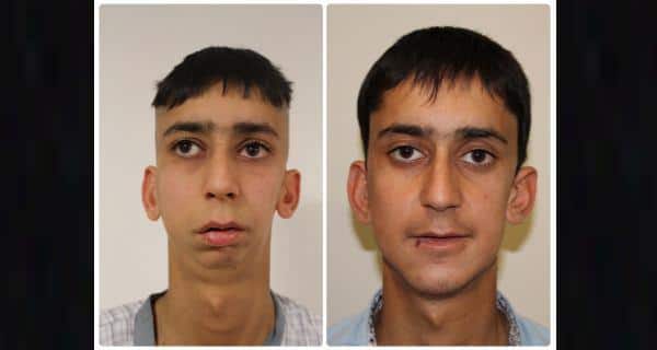 Man undergoes surgery to fix his fused jaw bone | TheHealthSite.com