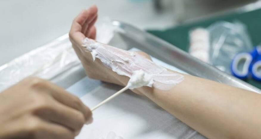 The many benefits of toothpaste -- treat burns, acne and sparkle your ...