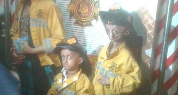 India's 1st Progeria Kids Meet helps create awareness about this rare ...