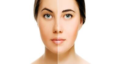 Skin lightening creams or natural remedies -- how to get rid of a sun ...