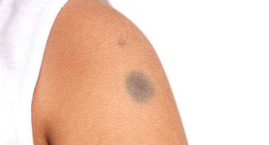 7 signs that you have healthy skin | TheHealthSite.com