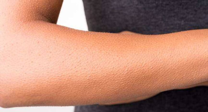 7 signs that you have healthy skin | TheHealthSite.com