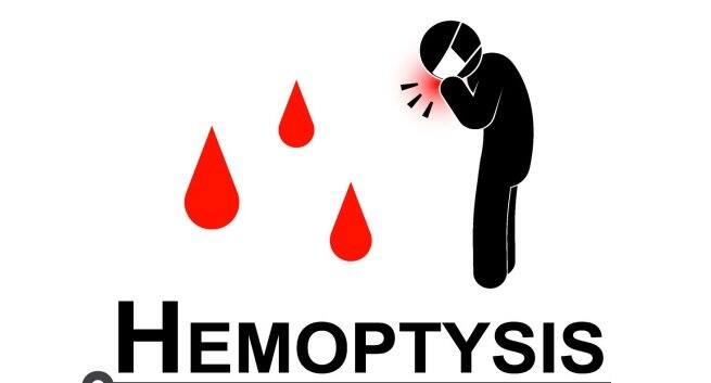 World TB Day – 7 signs and symptoms of tuberculosis you should not ...