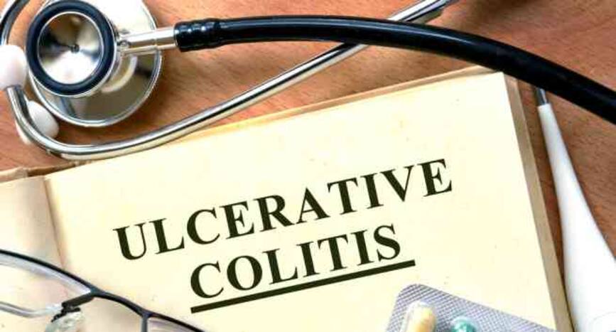 4 herbal remedies for Ulcerative Colitis | TheHealthSite.com