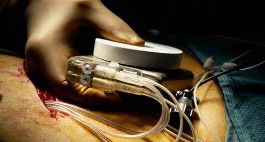 Can this new 'bionic' cardiac patch replace pacemakers in future ...