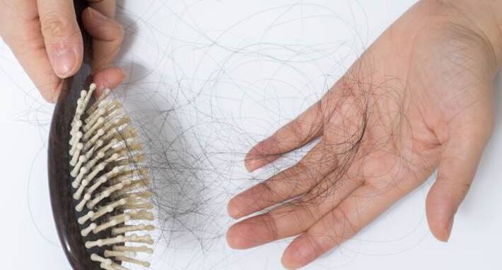 7 side effects of dandruff you MUST know! | TheHealthSite.com