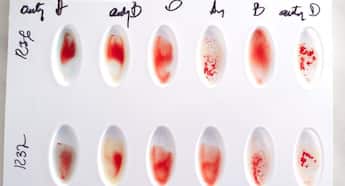 How to read your medical test report: Blood typing and blood cross ...
