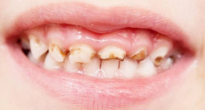 12 oral problems in children every parent should know about ...