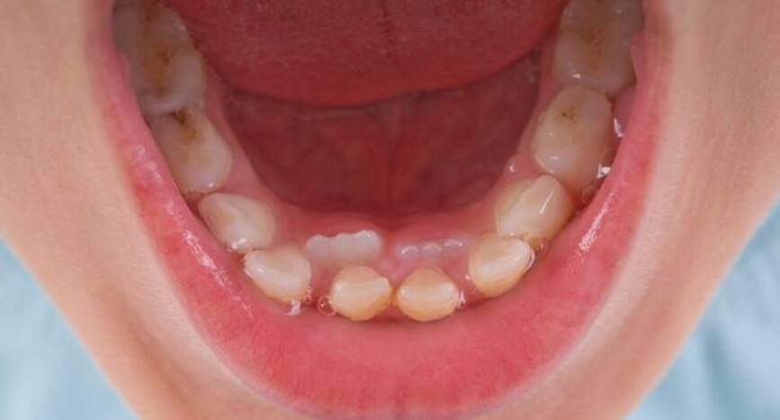 12 oral problems in children every parent should know about ...