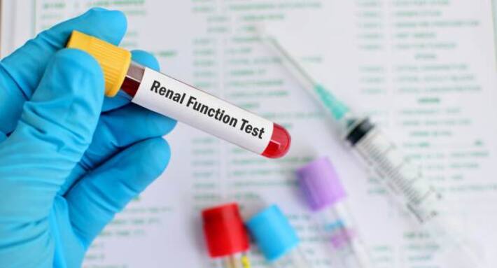 How to read your medical test report: Kidney function test ...
