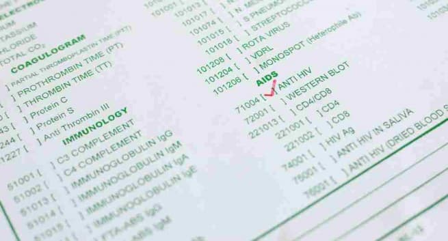 How to read your medical test report: Serologic tests | TheHealthSite.com