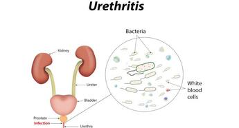 10 causes of itching, burning and redness in your penis (STDs not ...