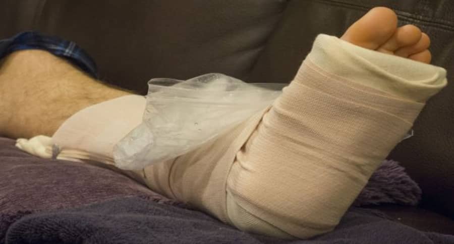 Fracture care: 5 dos and don’ts when you have a cast or splint ...