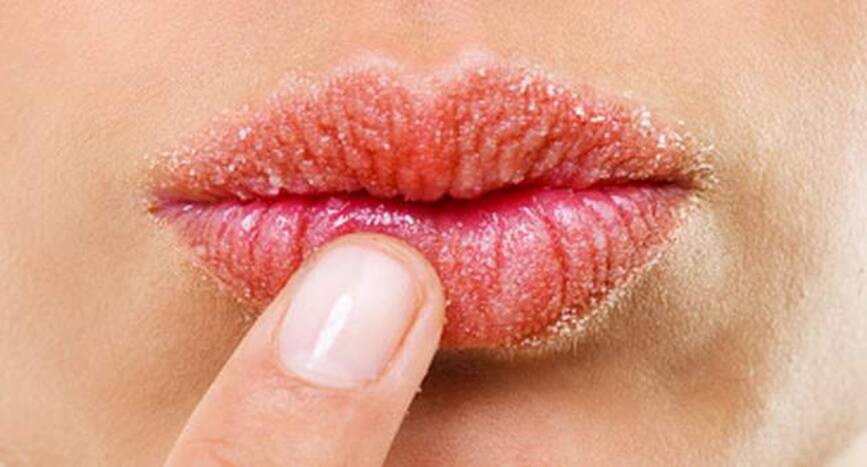 6 things your lips say about your health | TheHealthSite.com