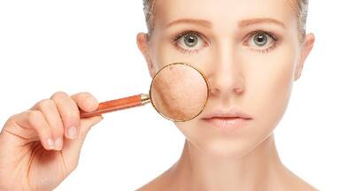 White patches on your skin? Could be a yeast infection and not vitiligo ...