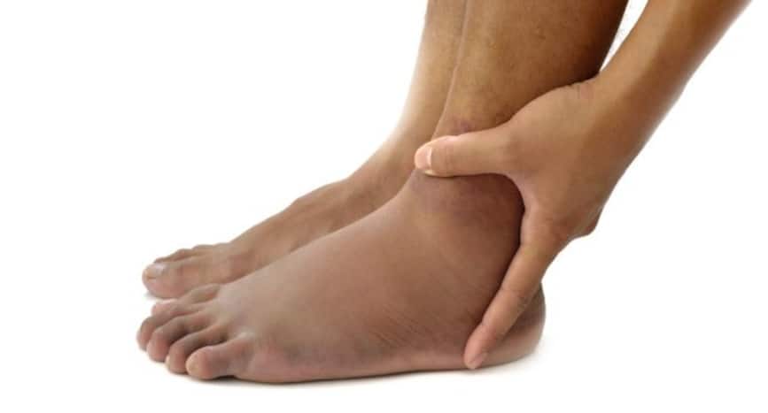 10 common causes of leg pain | TheHealthSite.com