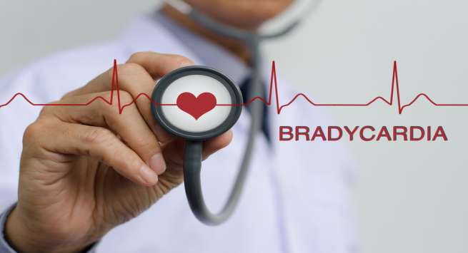 6 causes of bradycardia or decreased heart rate | TheHealthSite.com