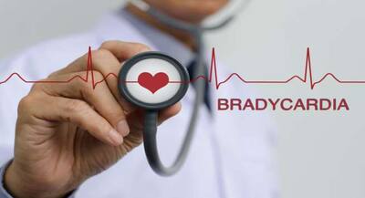 6 causes of bradycardia or decreased heart rate | TheHealthSite.com