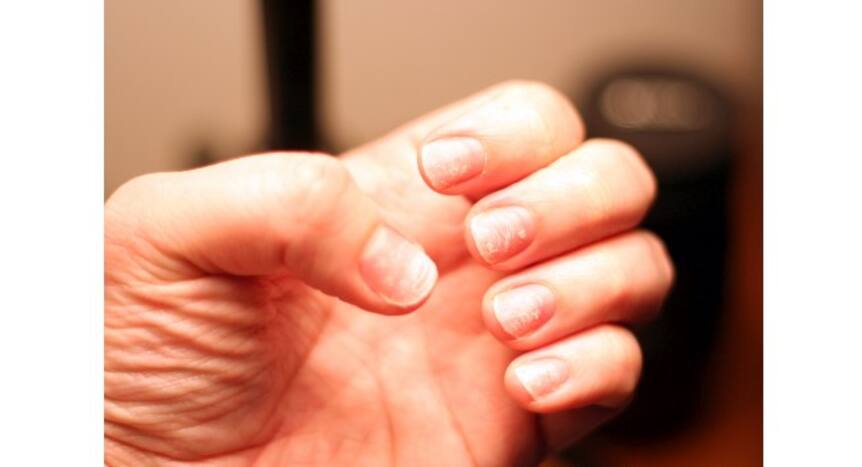 These harmful side effects of acetone-based nail polish removers will ...