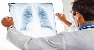 Chest X-ray -- everything you need to know | TheHealthSite.com