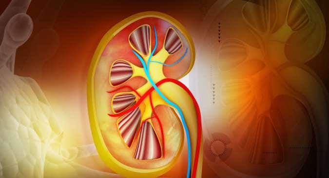 45 year old woman with ruptured and bleeding kidney tumour successfully ...