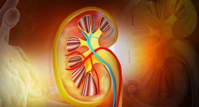 45 year old woman with ruptured and bleeding kidney tumour successfully ...