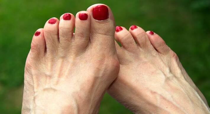 Signs and symptoms of 6 common feet problems | TheHealthSite.com