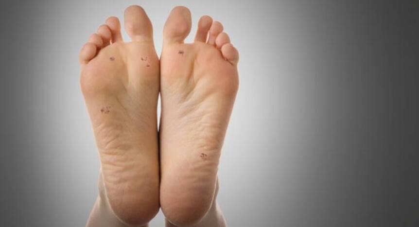 Signs and symptoms of 6 common feet problems | TheHealthSite.com