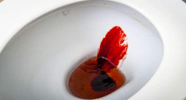 6 signs and symptoms of tapeworm infection | TheHealthSite.com