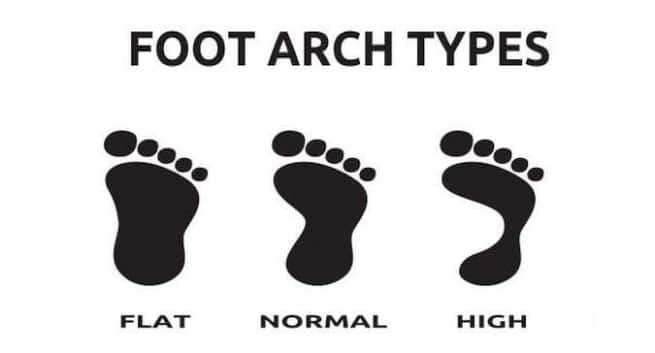 How to know your foot type to choose the right shoes for running ...