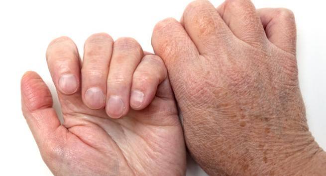 6 minor skin problems that could indicate major health conditions ...