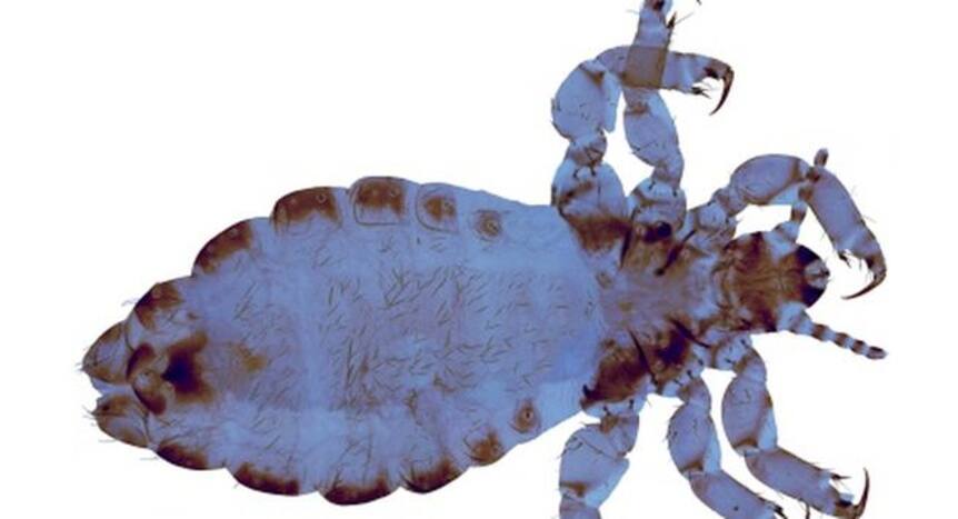 6 reasons your crotch is extremely itchy | TheHealthSite.com