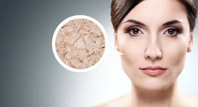 Try these easy home-made scrubs for dry skin | TheHealthSite.com