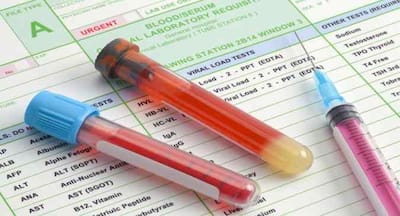 Liquid biopsy for cancer diagnosis -- what you need to know ...