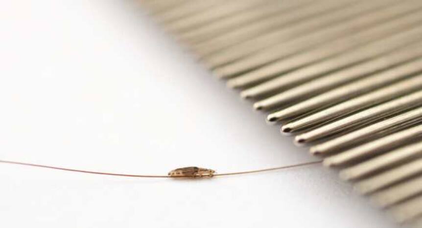 7 common causes of chronic itchy scalp | TheHealthSite.com